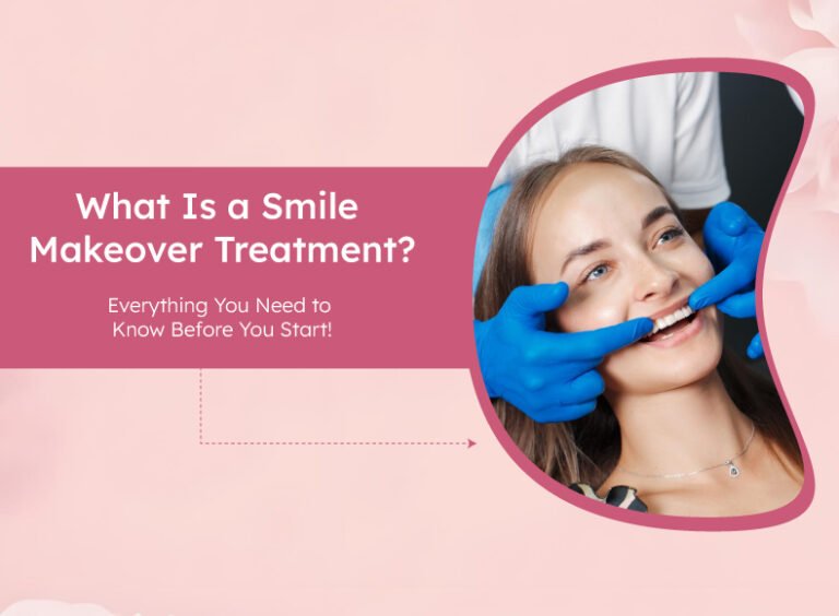 What Is a Smile Makeover? Complete Guide for You